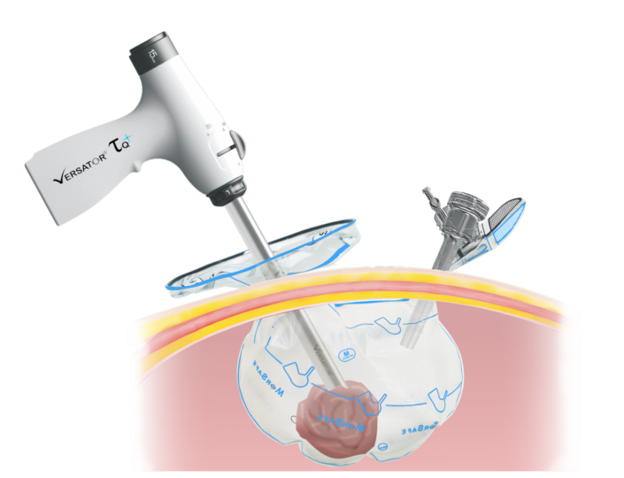 Morcellatie zak - Morsafe - Medical Dynamics